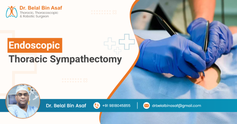 Endoscopic Thoracic Sympathectomy - Dr Belal Bin Asaf