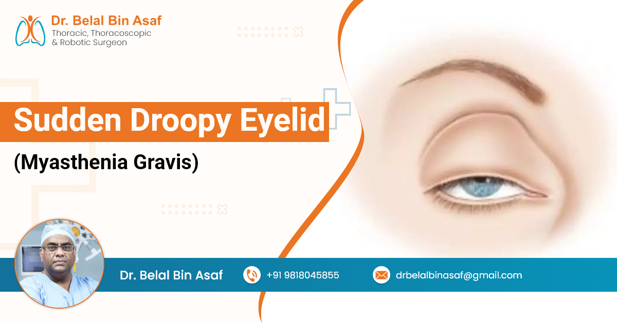 Sudden Droopy Eyelid Caused by Myasthenia Gravis
