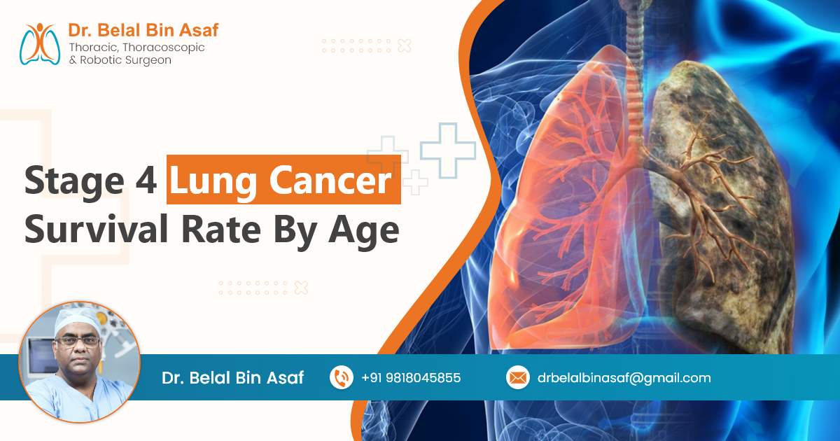 Stage 4 Lung Cancer Survival Rate By Age - Dr Belal BIn Asaf