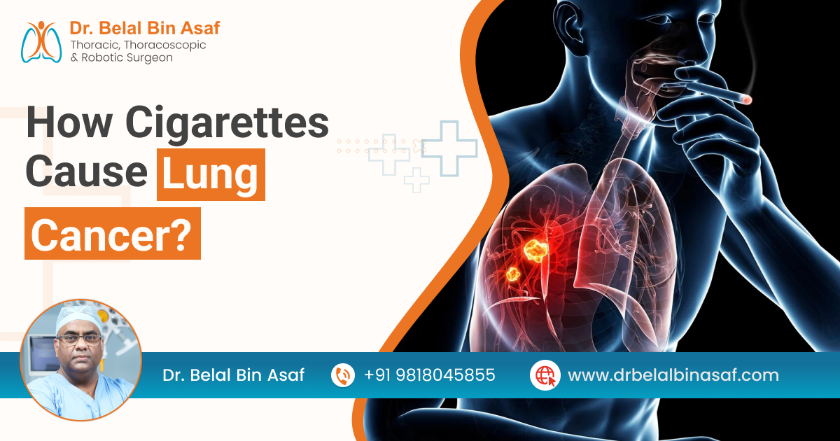 4 Symptoms of Lung Cancer That You Should be Aware of